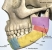 Jaw Fracture - Facial Trauma
